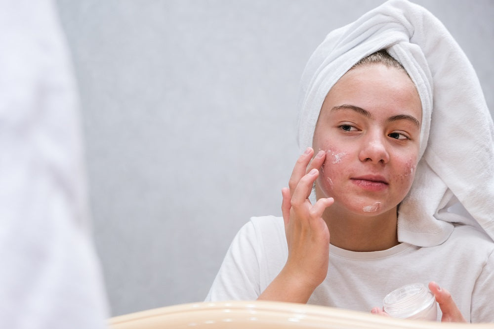 How to Get Rid of Acne: Effective Tips and Treatments - Ningen